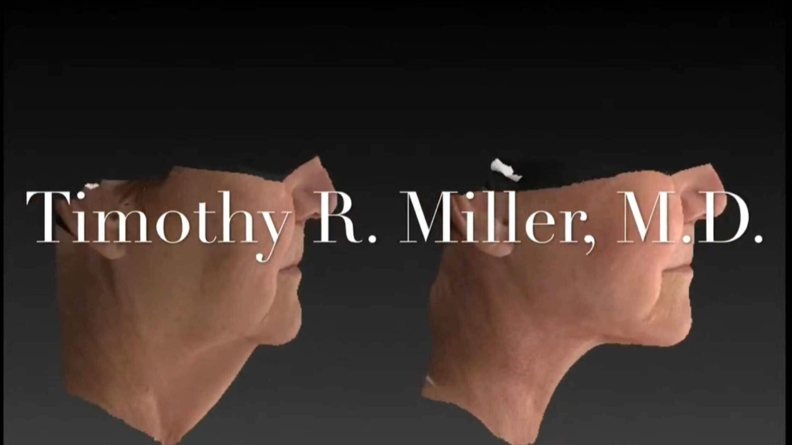 How Much Does A Neck Lift Cost? 2024